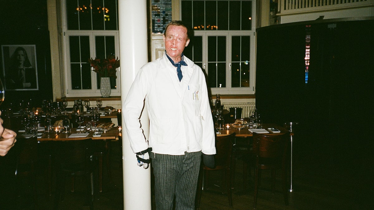 Grand brûlé, le chef David Heimer se bat pour revenir en cuisine ...